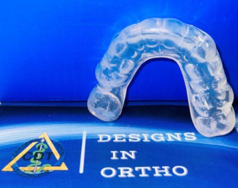 Custom Bite Guard | Custom Dental Flippers Mouthguards and Bite Guards ...